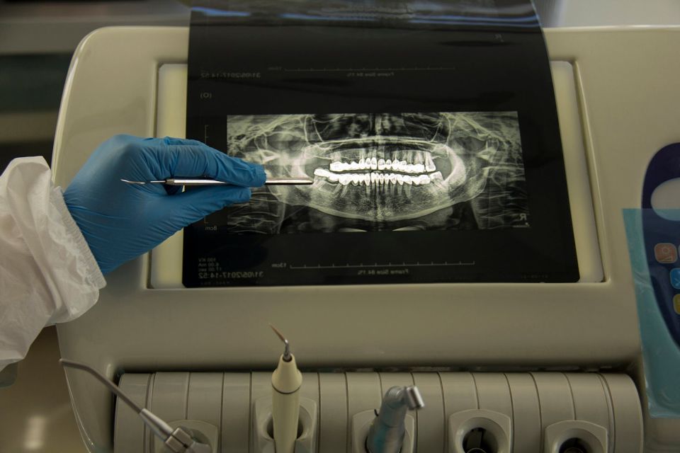 The toll of shrinking jaws on human health | Stanford Report