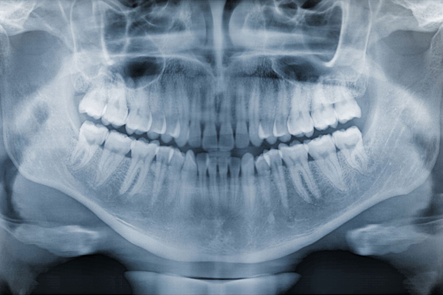 Paul Ehrlich on the problems of the modern jaw | Stanford Report