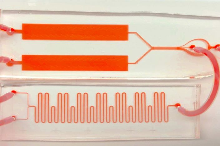 New blood-test device monitors blood chemistry continually | Stanford ...