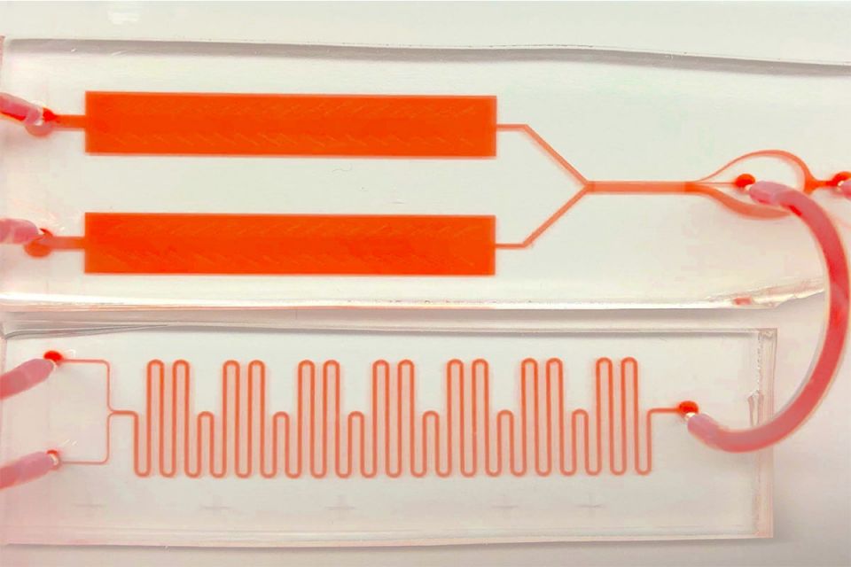 New blood-test device monitors blood chemistry continually | Stanford ...