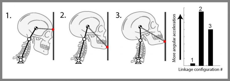 Head and neck positioning affects concussion risk | Stanford Report